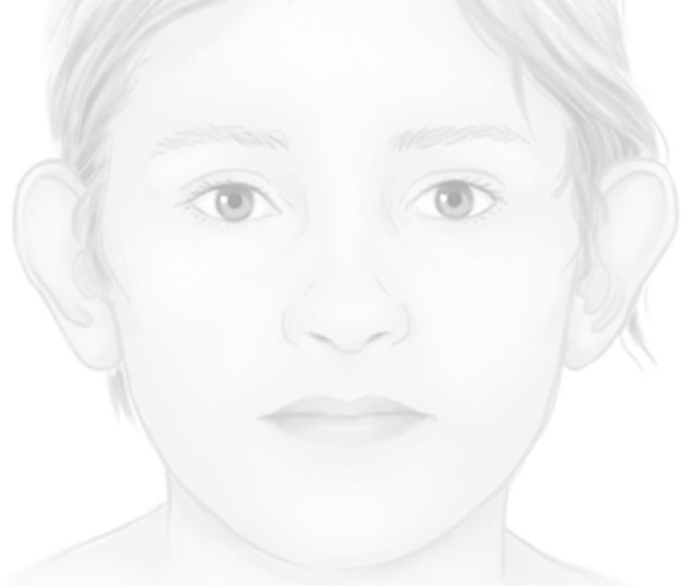 Chirurgie Esthétique à Paris 16 - Docteur Alexandre Marchac